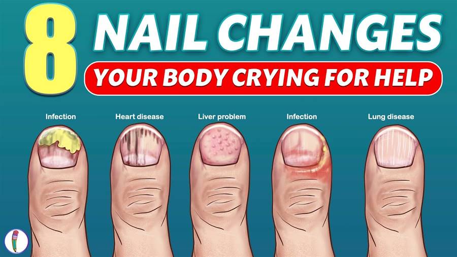 8 Nail Changes Means You Body Crying For The Help You Need to Focus!